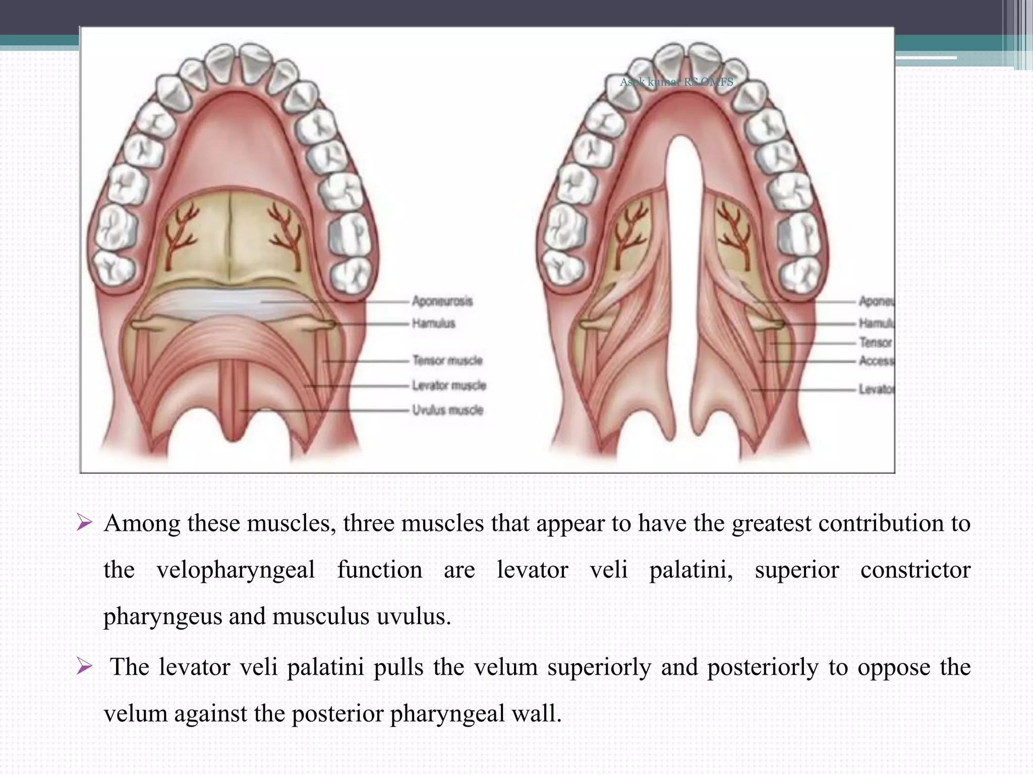 Cleft palate | PDF