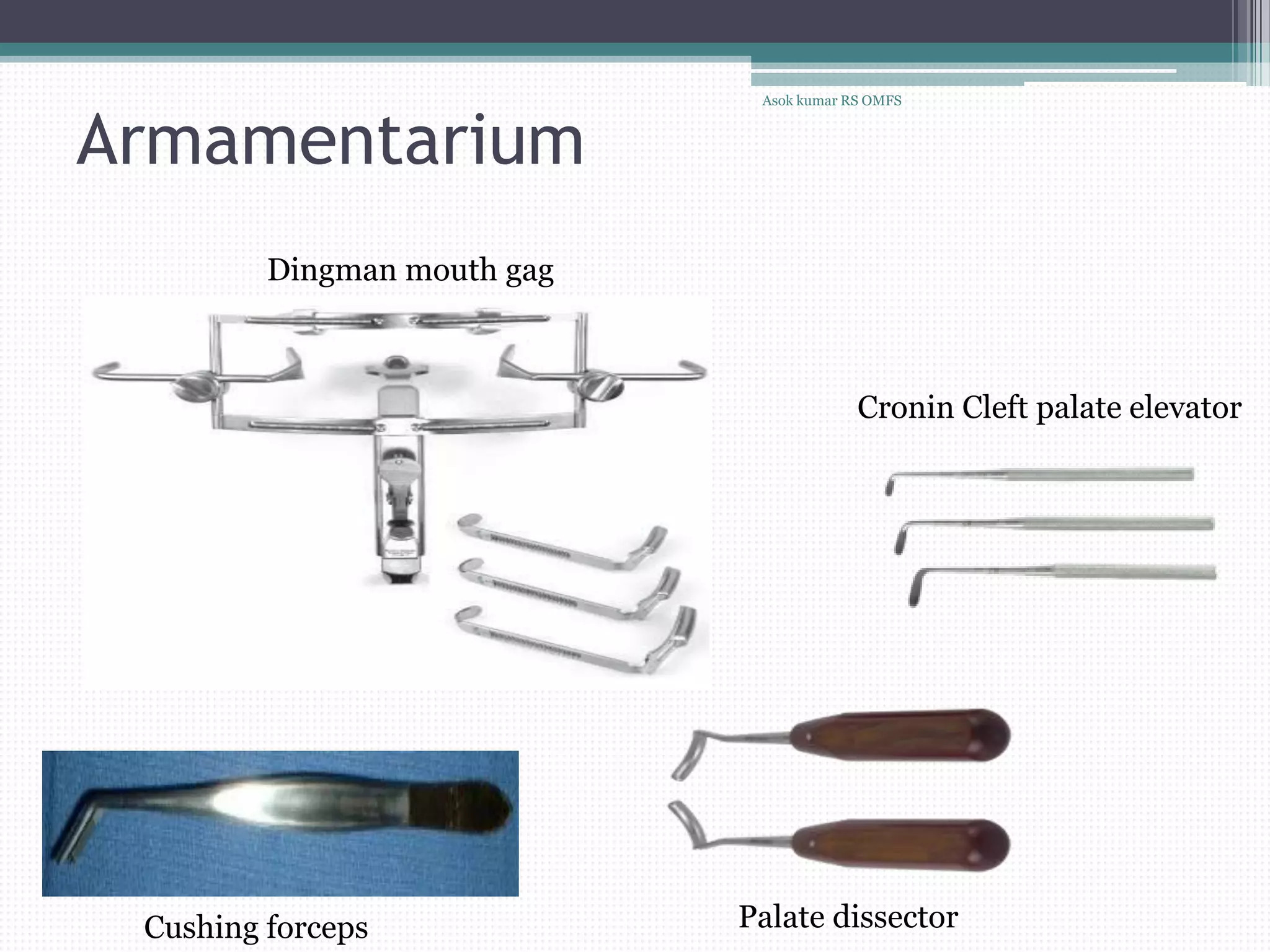 Cleft palate | PDF