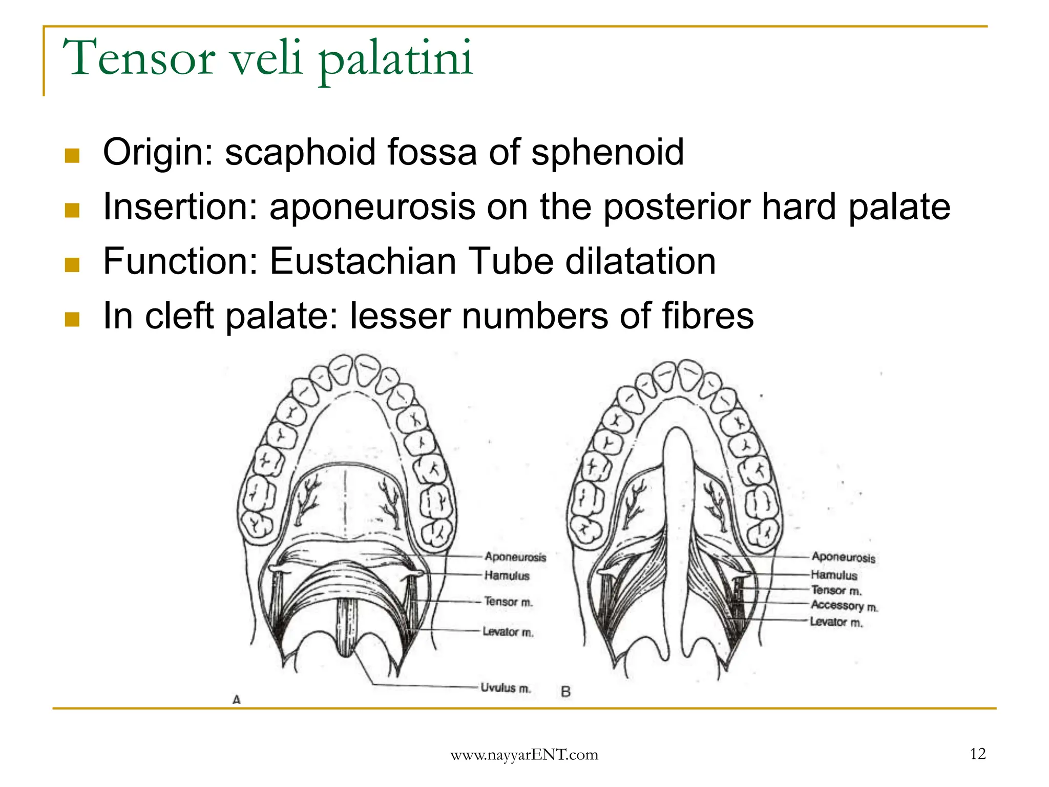 Cleft Palate Lip Bifid uvula submucosal cleft modified by Dr Nayyar.ppt