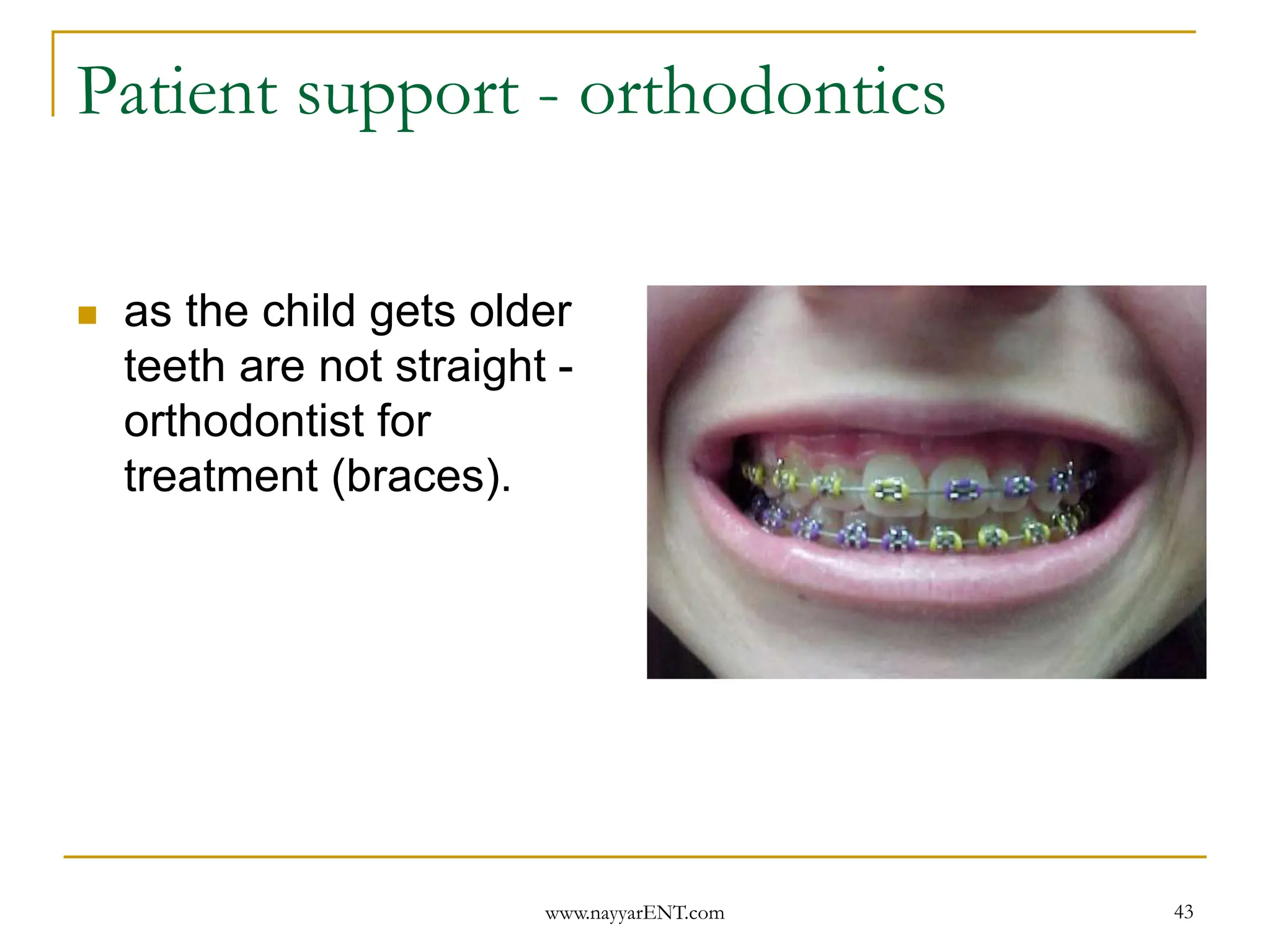 Cleft Palate Lip Bifid uvula submucosal cleft modified by Dr Nayyar.ppt
