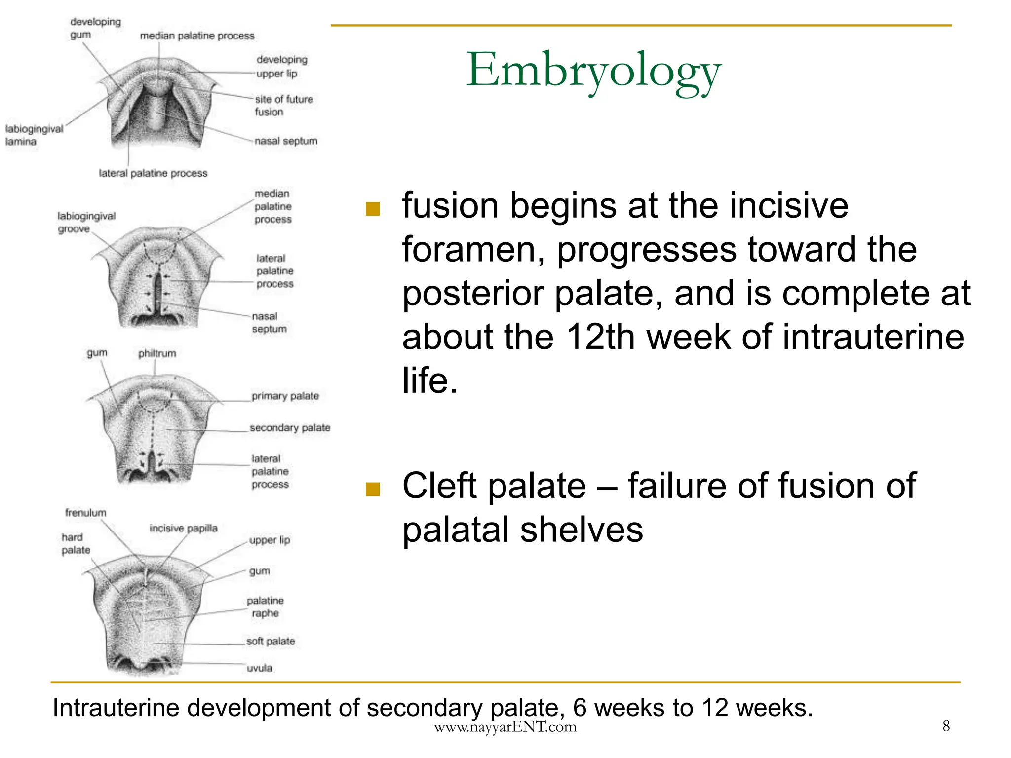 Cleft Palate Lip Bifid uvula submucosal cleft modified by Dr Nayyar.ppt ...