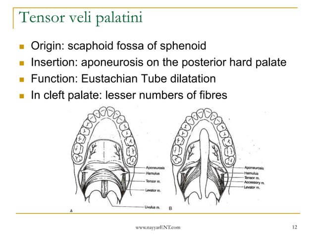 Cleft Palate Lip Bifid uvula submucosal cleft modified by Dr Nayyar.ppt ...