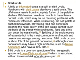 Cleft Palate Lip Bifid uvula submucosal cleft modified by Dr Nayyar.ppt ...
