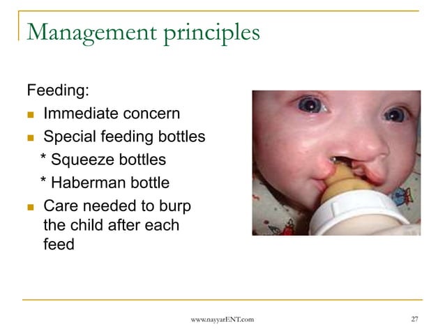 Cleft Palate Lip Bifid uvula submucosal cleft modified by Dr Nayyar.ppt ...