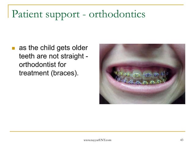 Cleft Palate Lip Bifid uvula submucosal cleft modified by Dr Nayyar.ppt ...