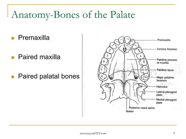 Cleft Palate Lip Bifid uvula submucosal cleft modified by Dr Nayyar.ppt ...
