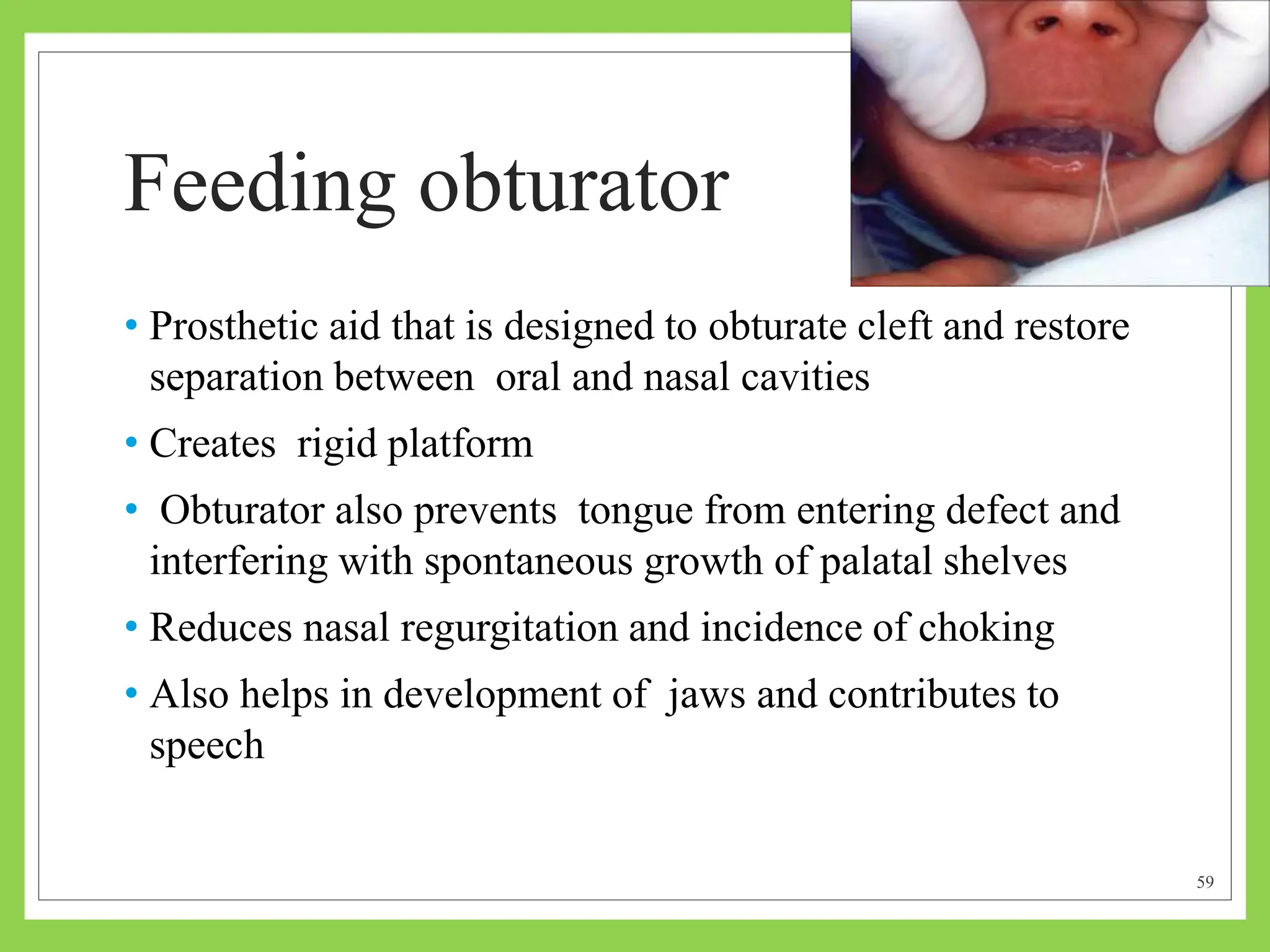 cleft lip and Cleft Palate Rehabilitation | PPTX
