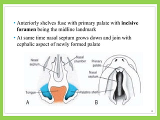 cleft lip and Cleft Palate Rehabilitation | PPTX