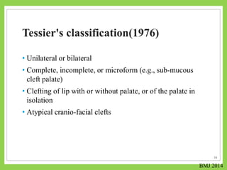 cleft lip and Cleft Palate Rehabilitation | PPTX