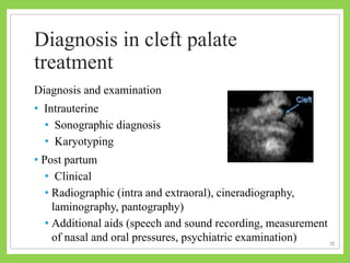 cleft lip and Cleft Palate Rehabilitation | PPTX