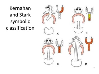 Cleft palate repair | PPTX
