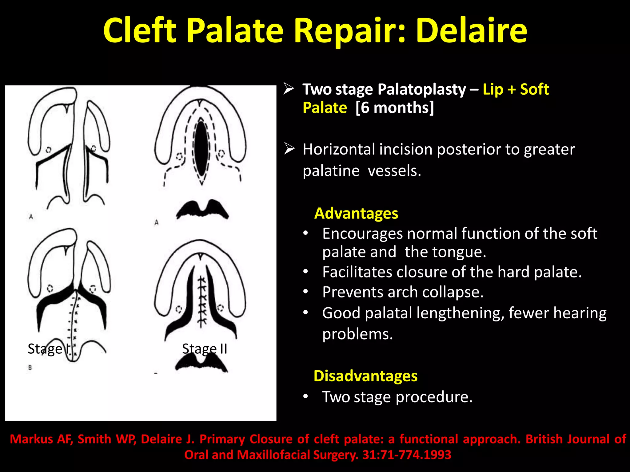 Cleft Palate & It's Management | PPTX
