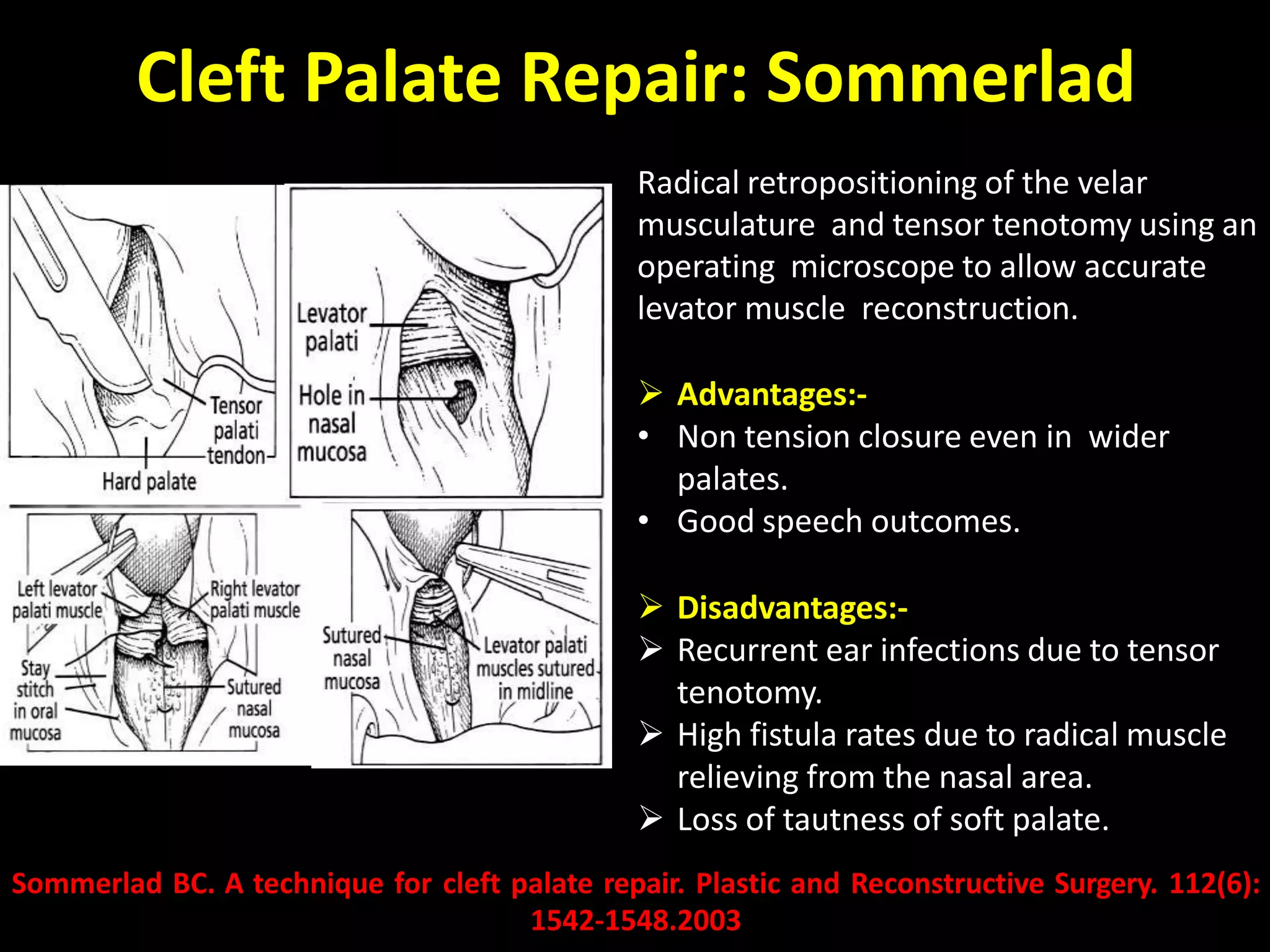 Cleft Palate & It's Management | PPTX