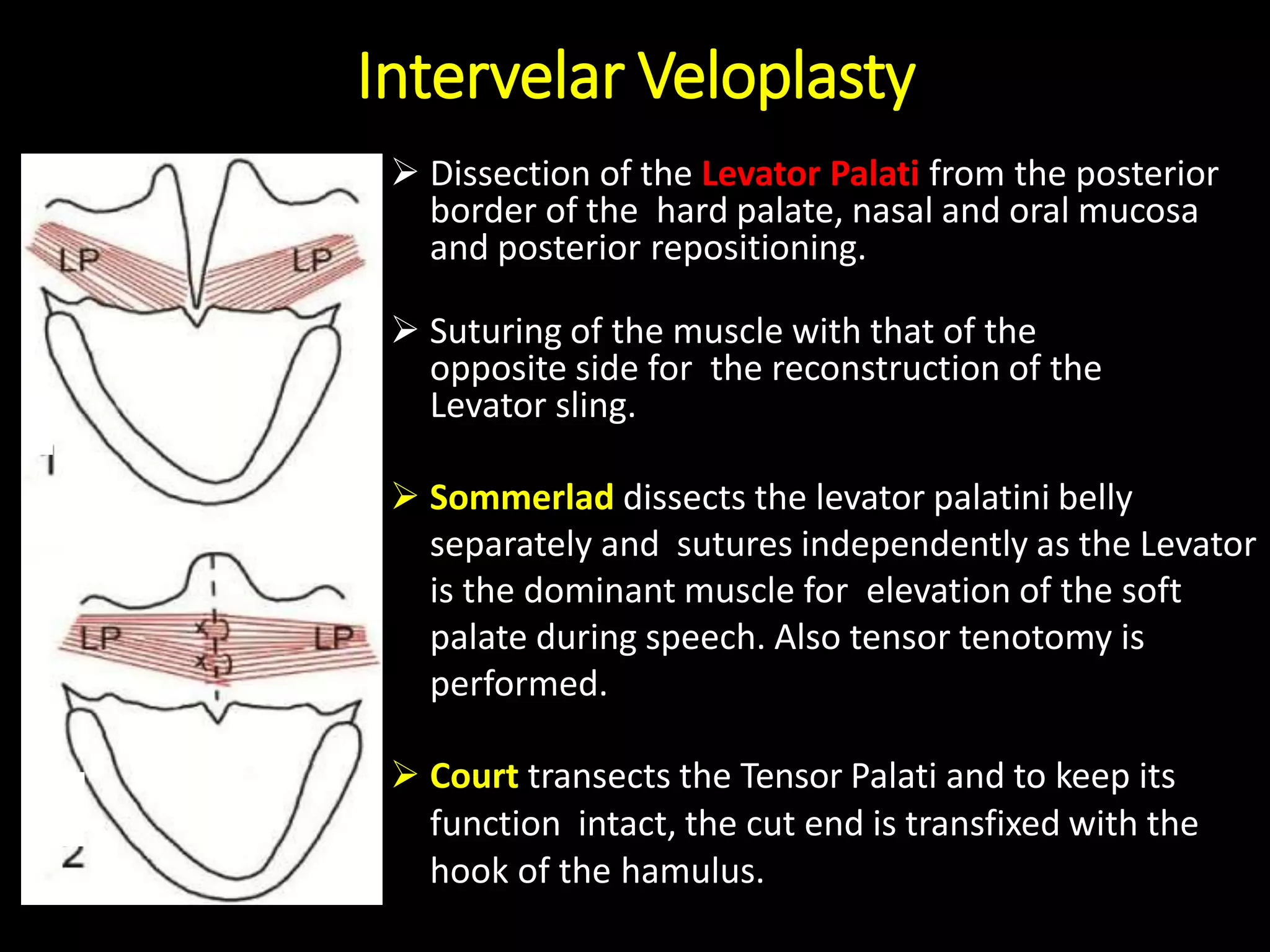 Cleft Palate & It's Management | PPTX