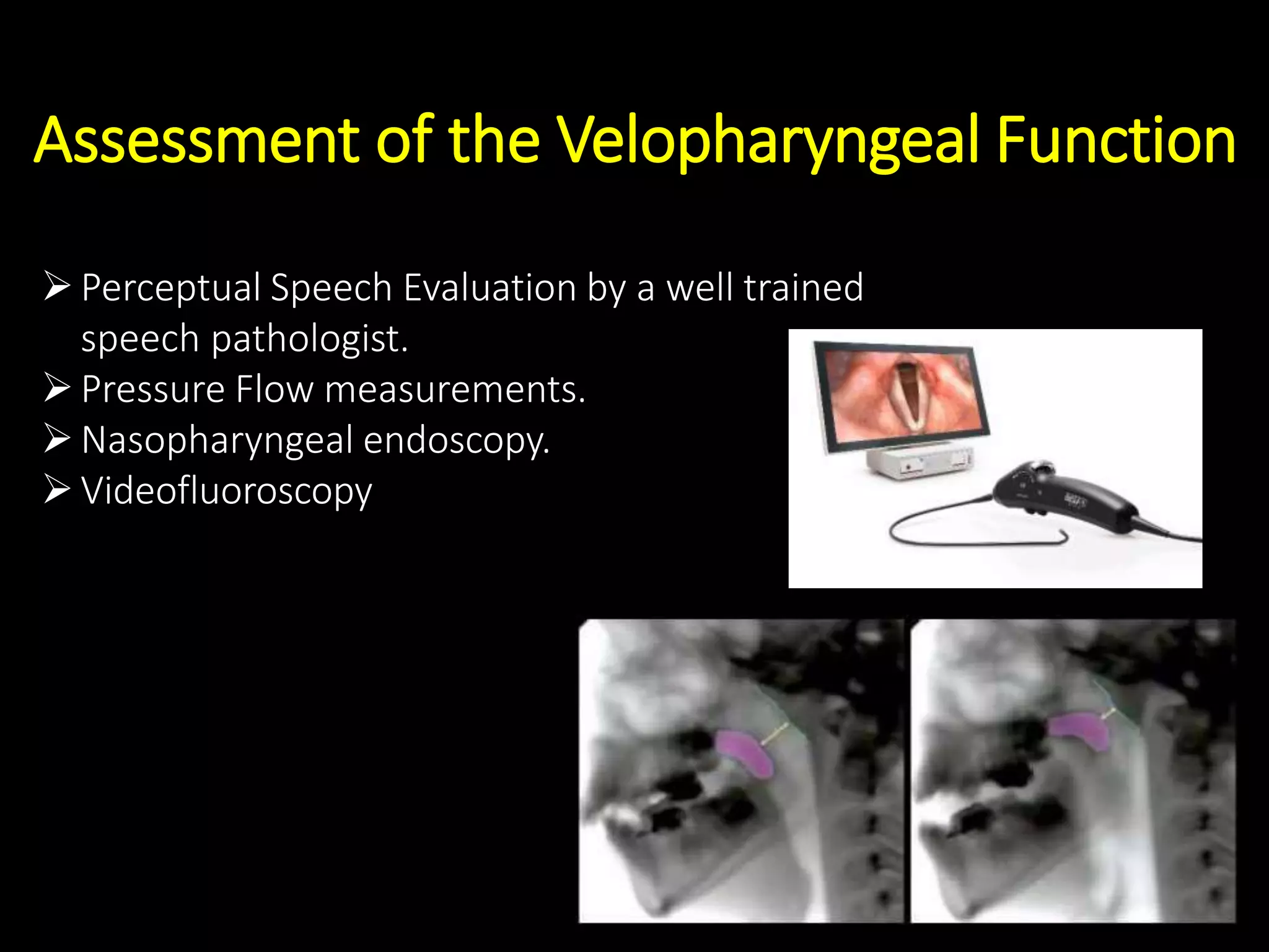 Cleft Palate & It's Management | PPTX