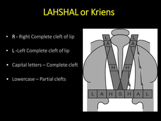 Cleft Palate & It's Management | PPTX