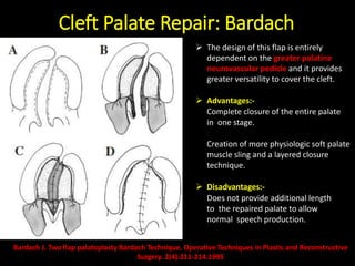 Cleft Palate & It's Management | PPTX