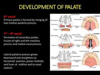 Cleft Palate & It's Management | PPTX