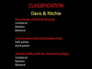 Cleft Palate & It's Management | PPTX