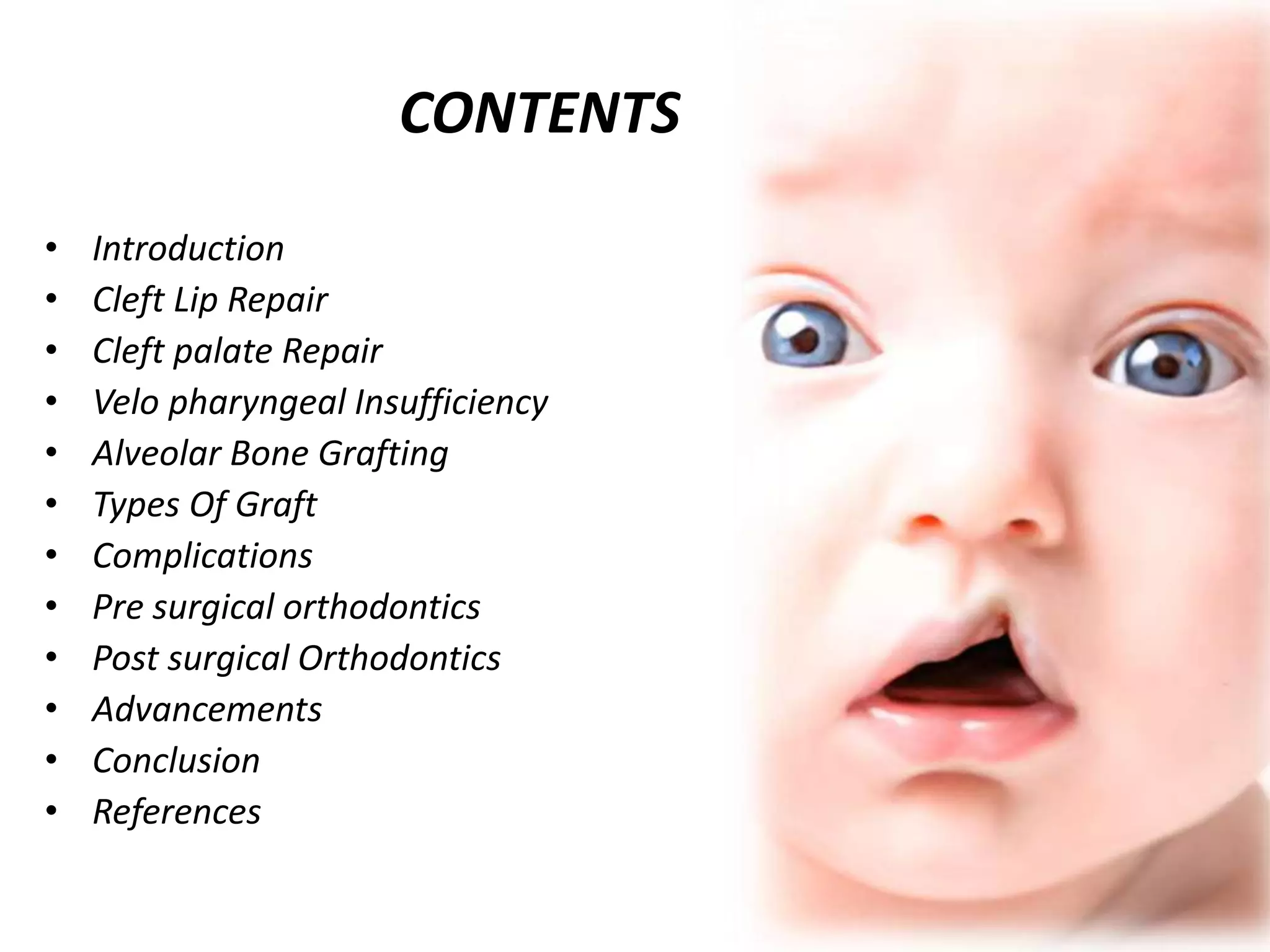 CLEFT LIP AND PALATE PART 3 - SURGICAL.pptx