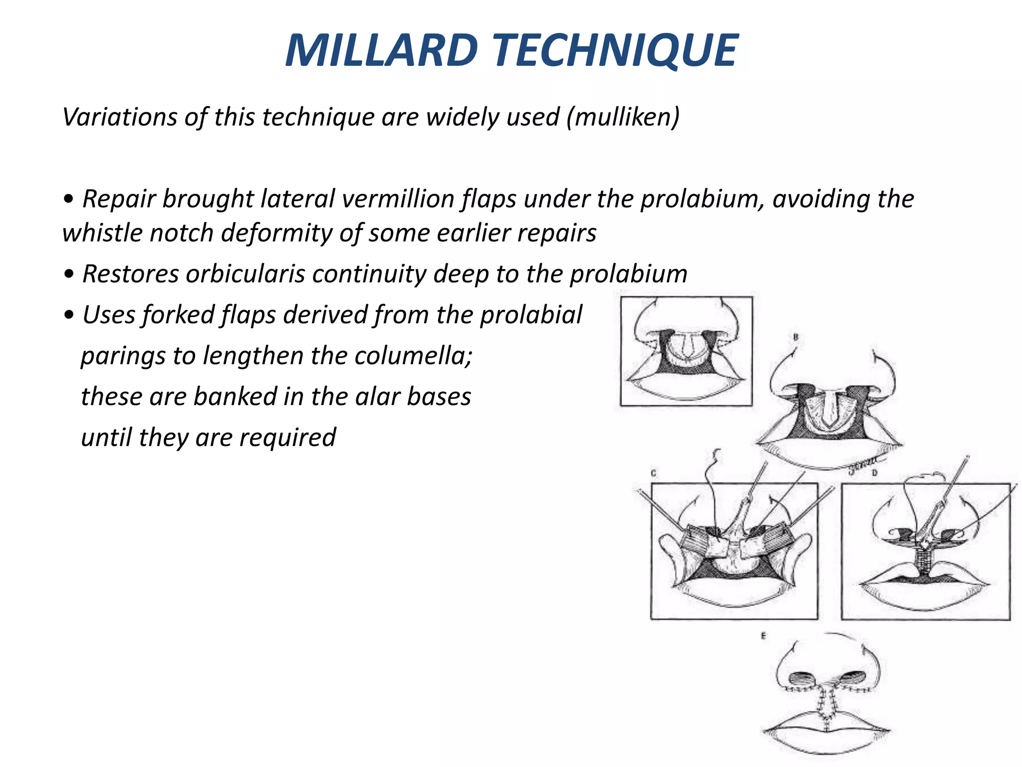 CLEFT LIP AND PALATE PART 3 - SURGICAL.pptx