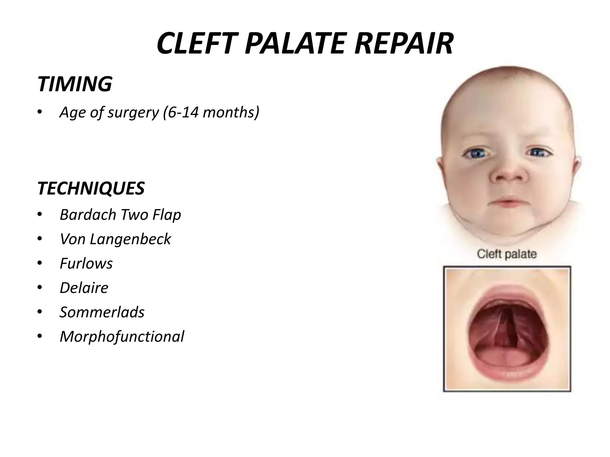 CLEFT LIP AND PALATE PART 3 - SURGICAL.pptx