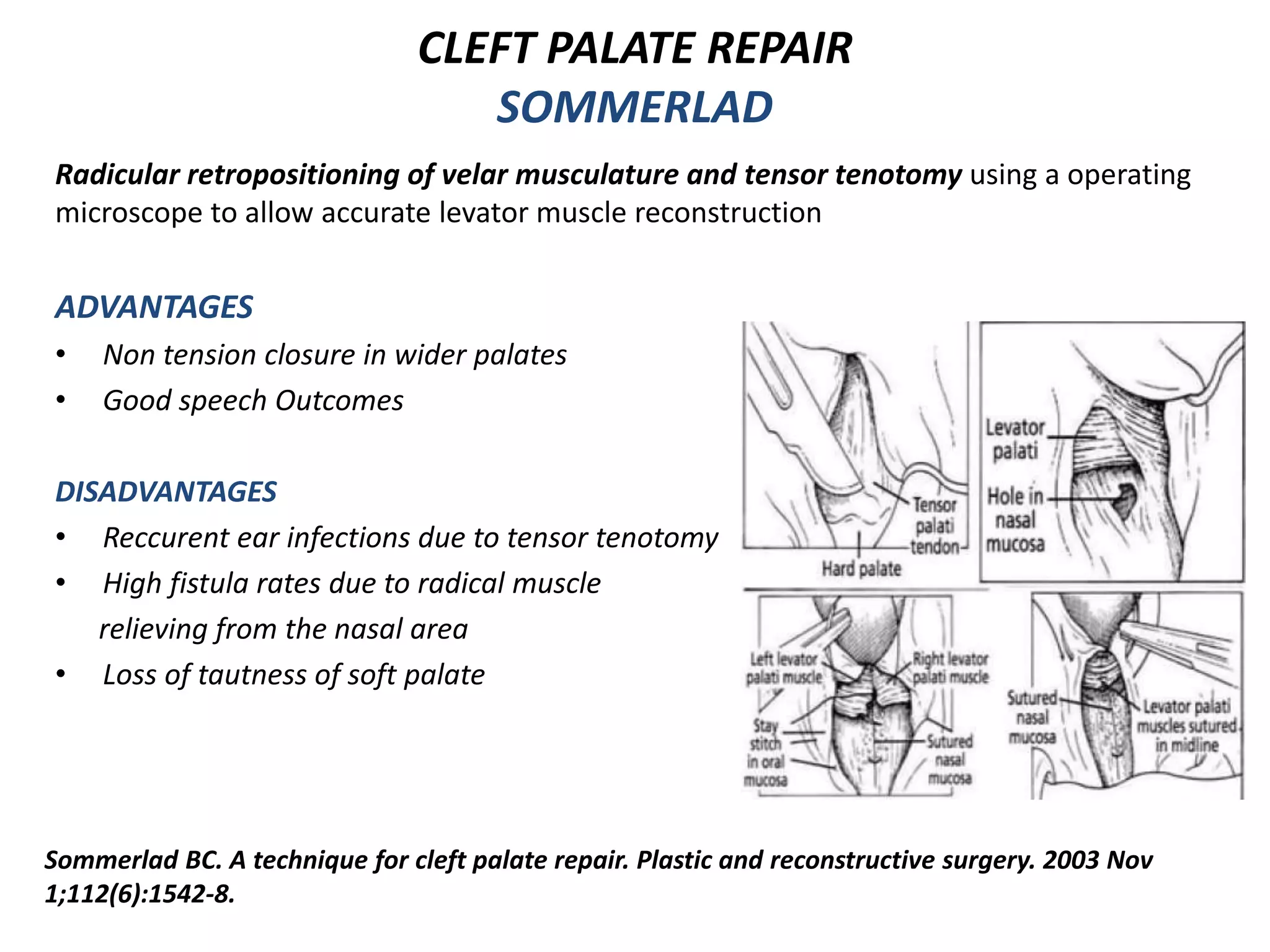 CLEFT LIP AND PALATE PART 3 - SURGICAL.pptx