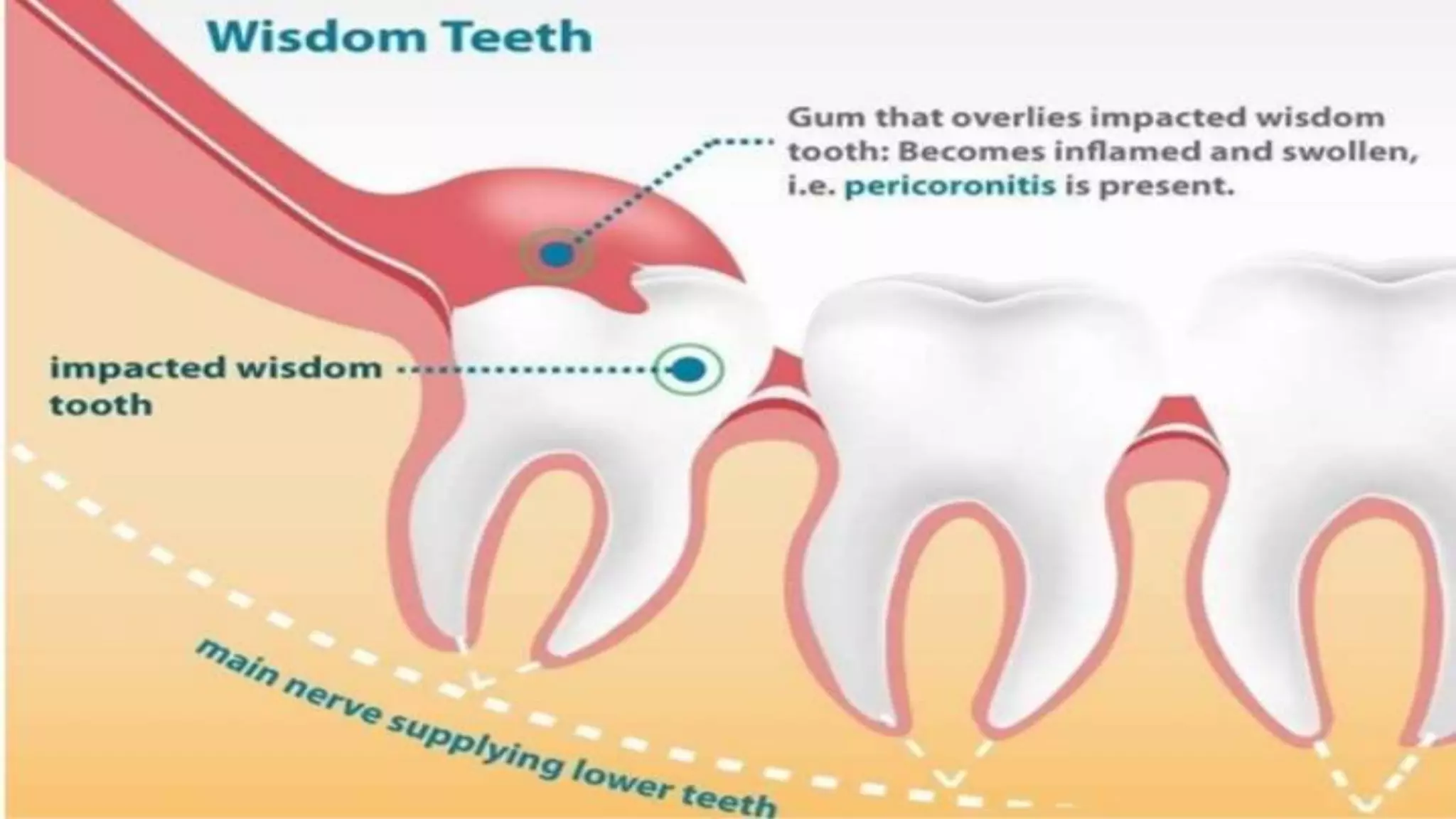 common oral disease and condition | PPTX