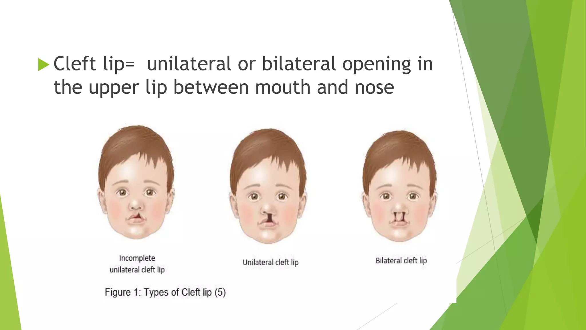 common oral disease and condition | PPTX