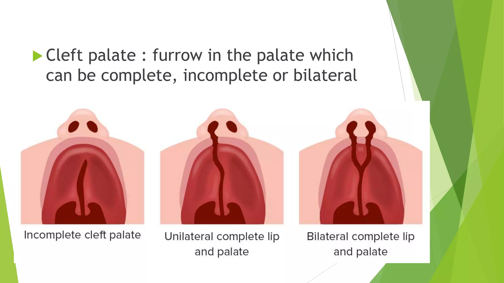 common oral disease and condition | PPTX