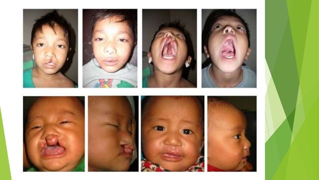 common oral disease and condition | PPT