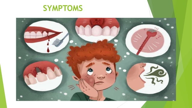 common oral disease and condition | PPT