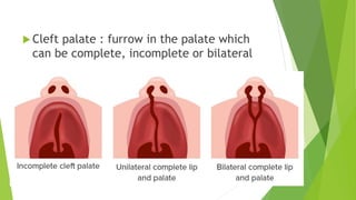 common oral disease and condition | PPTX