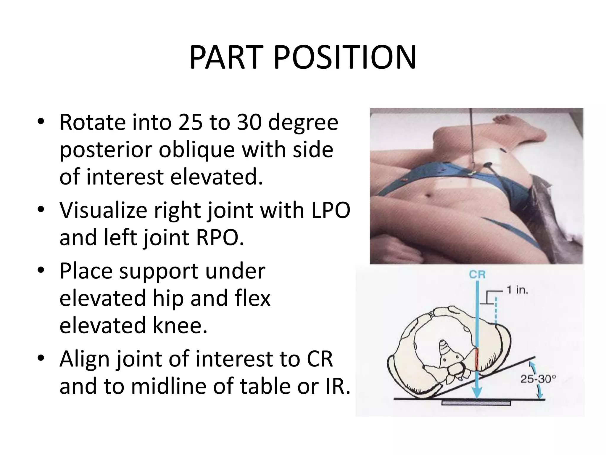 Clement nakayama method | PPTX