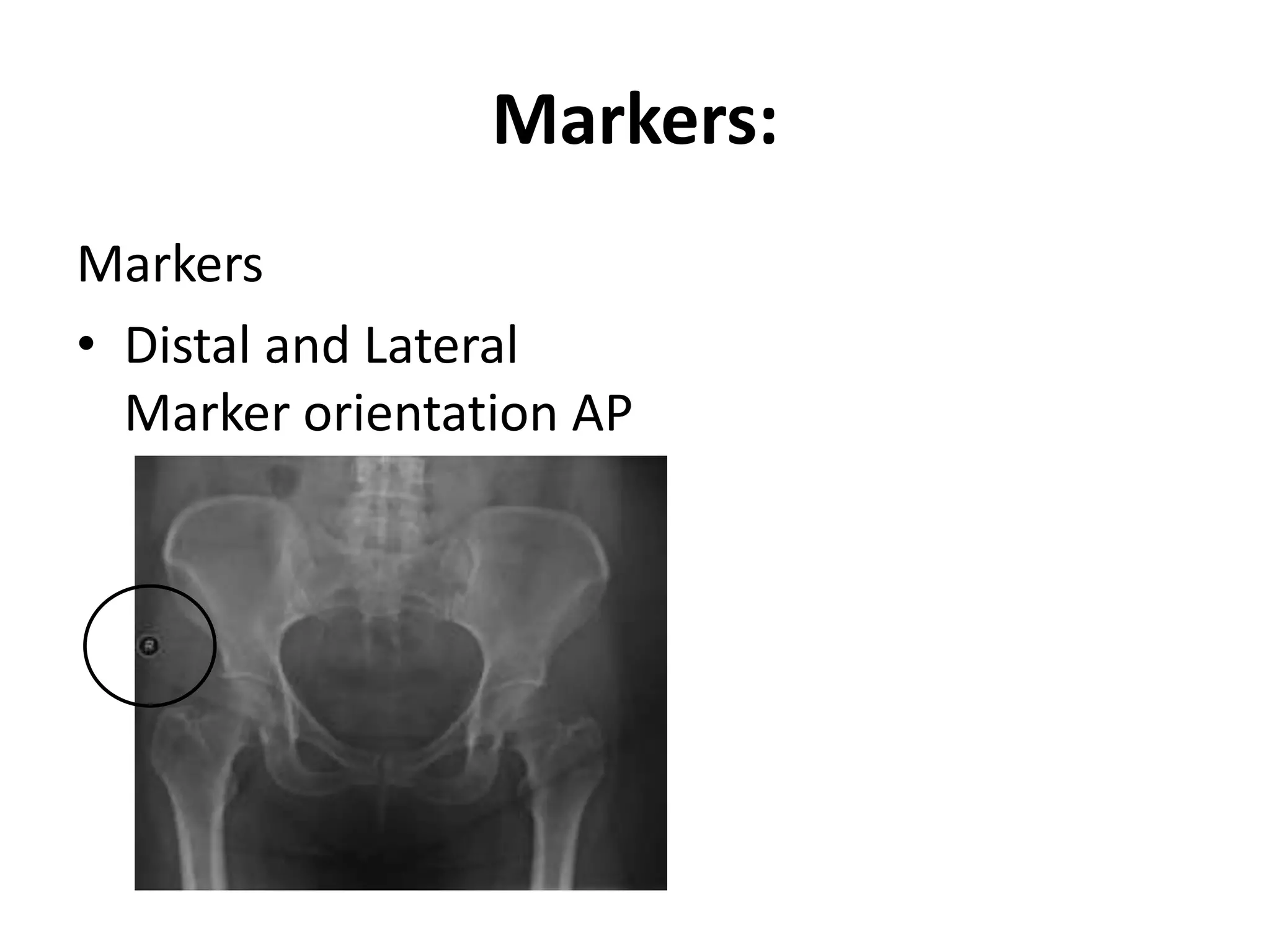 Clement nakayama method | PPTX