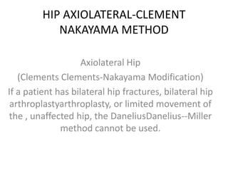 Clement nakayama method | PPTX
