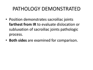 Clement nakayama method | PPTX