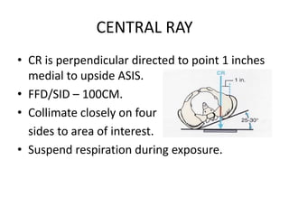 Clement nakayama method | PPTX