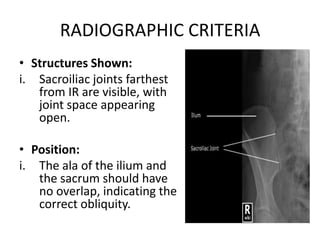 Clement nakayama method | PPTX