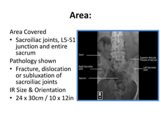 Clement nakayama method | PPTX