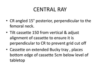 Clement nakayama method | PPTX