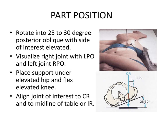 Clement nakayama method