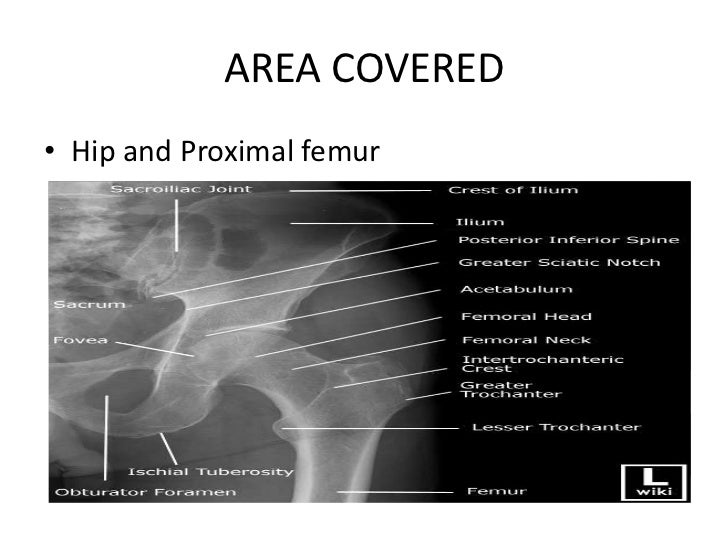Clement nakayama method