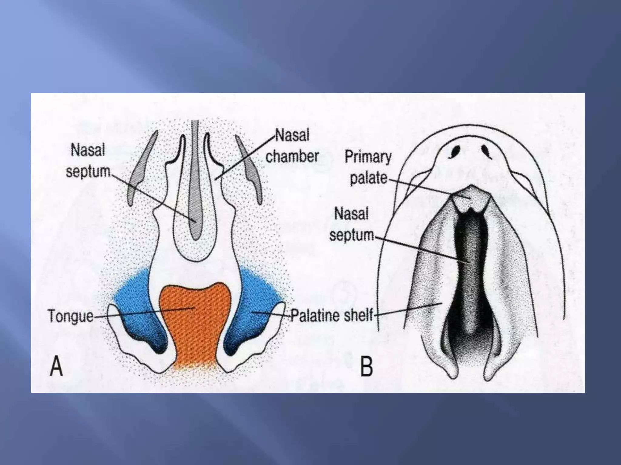 Clet lip and palate | PPTX