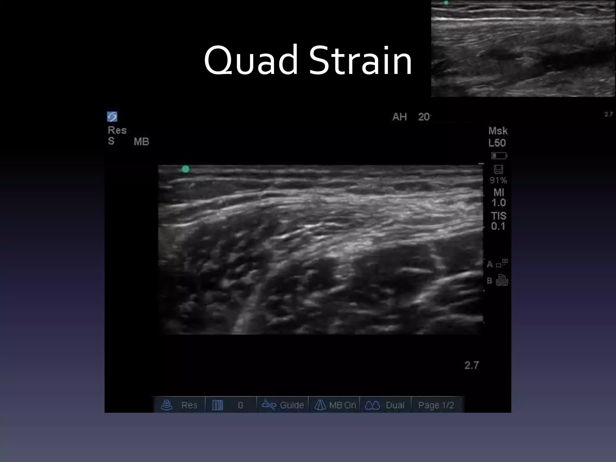 Ultrasound - Bone, muscle, soft tissue | PDF