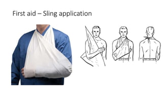 clavicle fracture.pptx