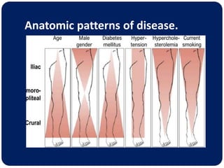 Chronic Limb Threatening Ischemia (PVD).pptx