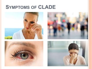 Contact Lens Induced Dry Eyes (CLIDE) | PPTX