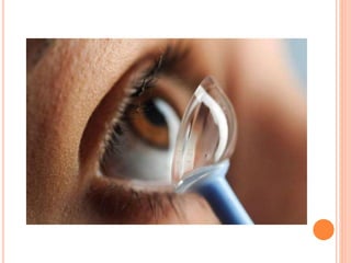 Contact Lens Induced Dry Eyes (CLIDE) | PPTX