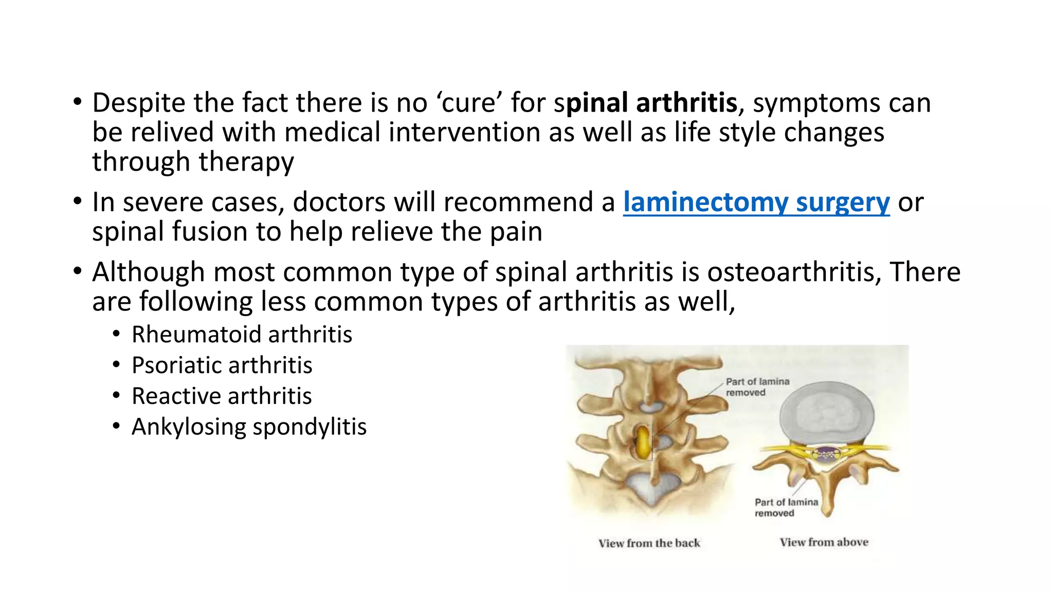 client care for arthritis.pptx